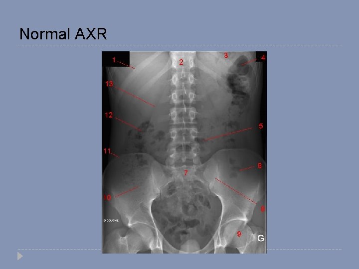 Radiology of the abdomen Radiological modalities 1 2