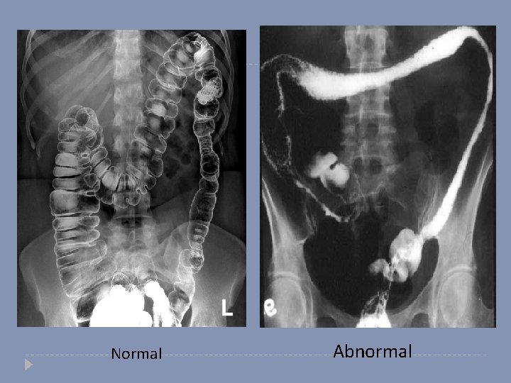 Radiology of the abdomen Radiological modalities 1 2
