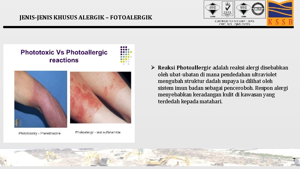 KAWALAN KESELAMATAN DAN KESIHATAN PEKERJAAN BERKAITAN KULIT DARI