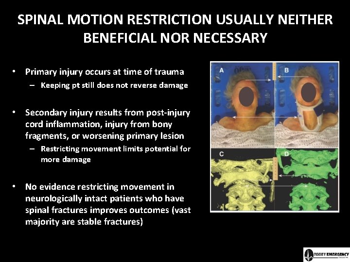 Prehospital Selective Cervical Spinal Clearance Amy Gutman MD