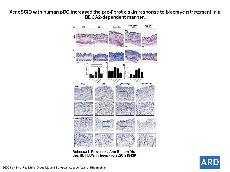 Targeting human plasmacytoid dendritic cells through BDCA 2