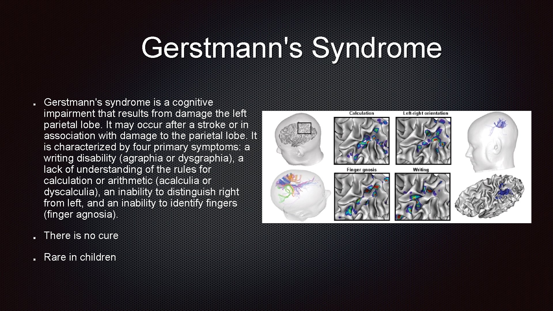 The Parietal Lobe By Melanie G Jordyn B