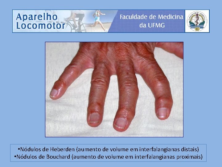 Banco de imagens Aparelho locomotor Semiologia Mdica II