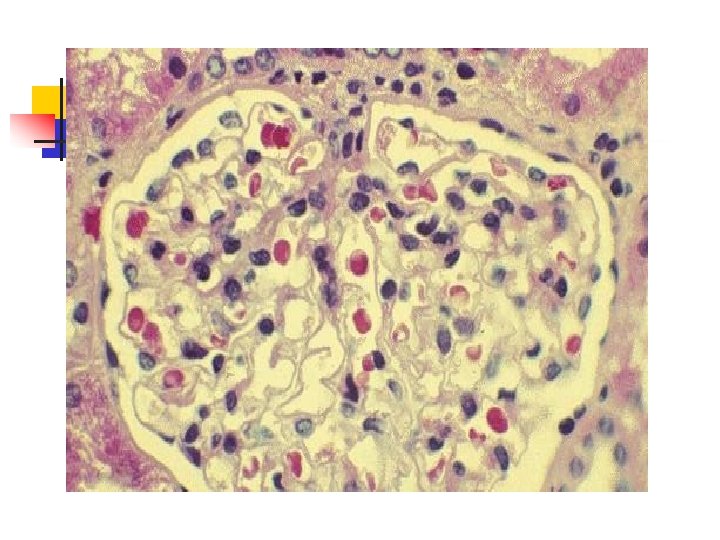 This is a normal glomerulus by light microscopy