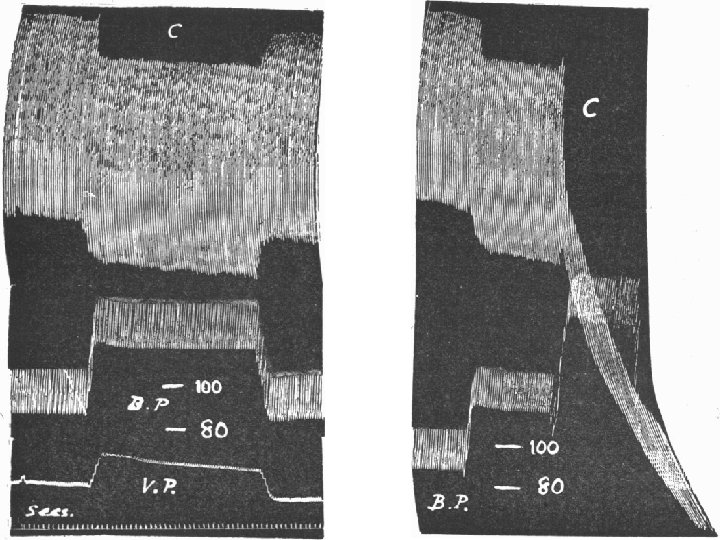 La legge di Frank Starling legge del cuore