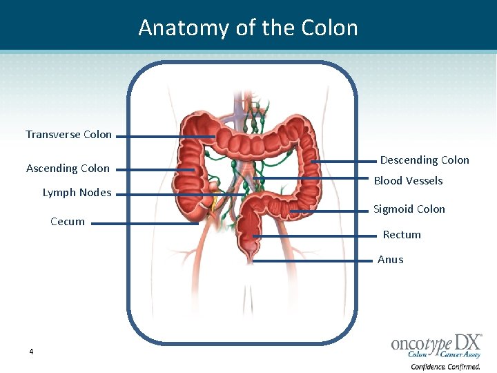 Patient Guide to Colon Cancer Surgery and Treatment