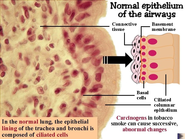Biology 16 18 Cancer Genes that control cell