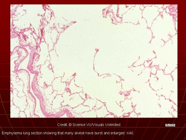 RESPIRATORY SYSTEM Breathing mechanics understanding pressurevolume Gas ...