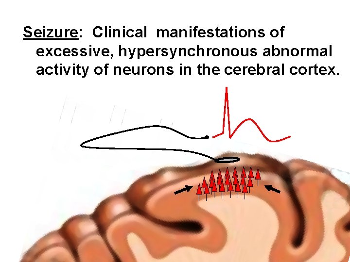 Systems biology of human brain activity Computationalexperimental ...