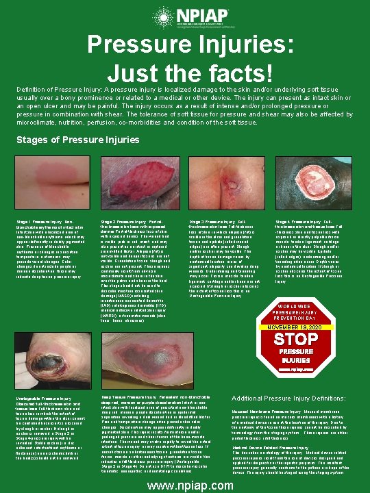 Pressure Injuries Just the facts Definition of Pressure