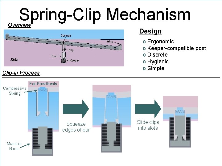 Prosthetic Ear Fixation March 9 2007 Design Team