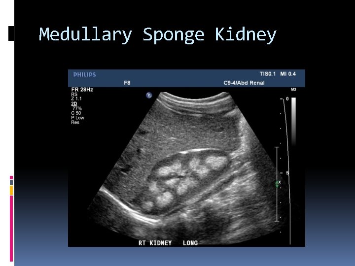Holdorf ULTRASOUND OF THE ABDOMEN PART I LECTURE