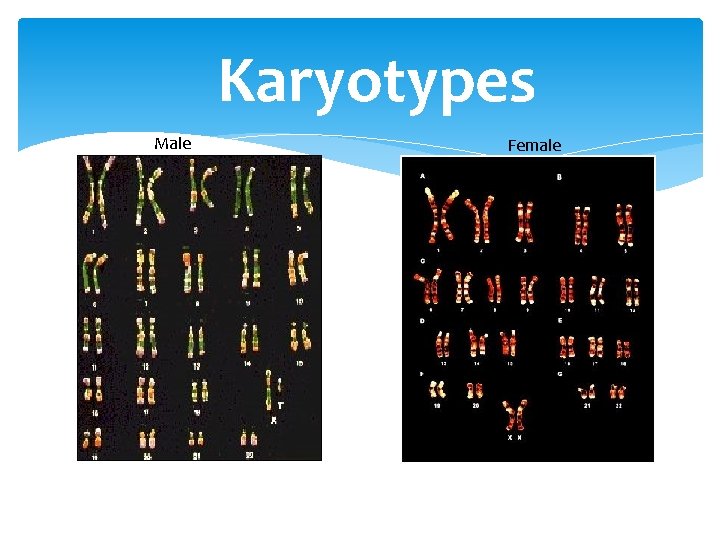 14 1 Human Heredity Human Chromosomes Karyotype a