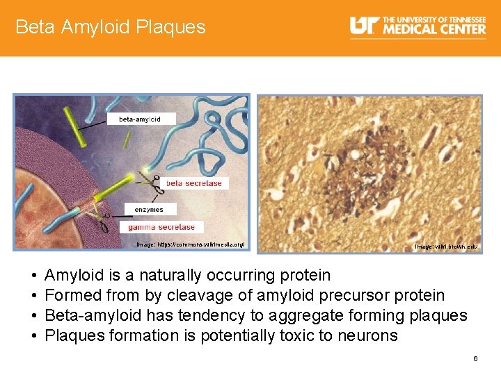 Overview of Alzheimers Research Roberto Fernandez MD MPH