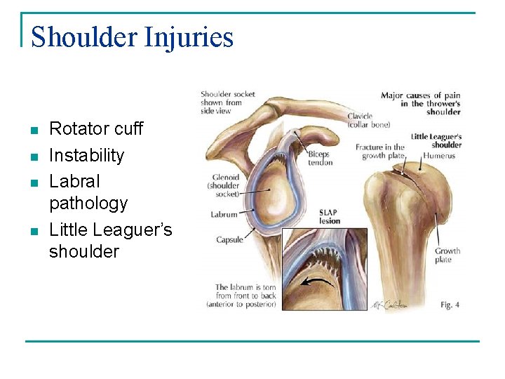 Upper Extremity Injuries in Youth Baseball Causes and