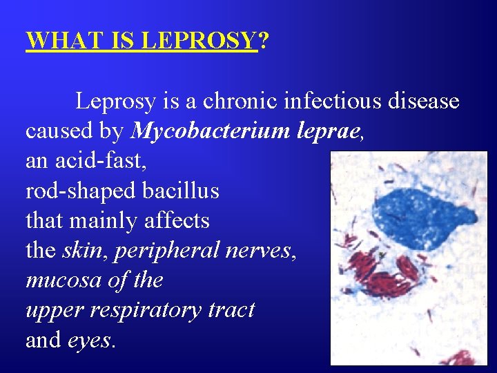 Module 1 LEPROSY The Disease WHAT IS LEPROSY