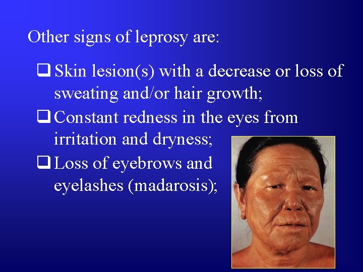 Module 1 LEPROSY The Disease WHAT IS LEPROSY