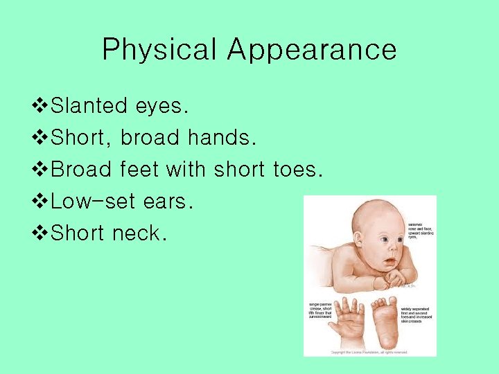 Down Syndrome Mary Elizabeth Bruner PLTW PBS B