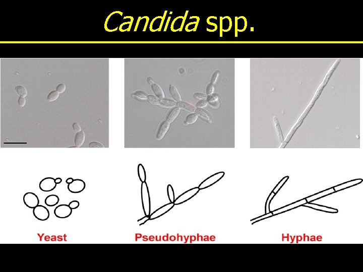 Systemic Fungal Infections Brad Spellberg MD FIDSA FACP
