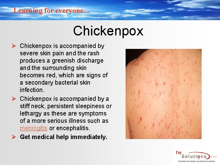 Learning for everyone Childhood illnesses Measles and Chickenpox