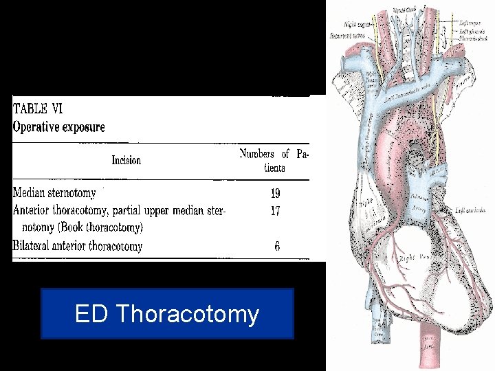 Great Vessels Anatomy Innominate Injuries Martha A Quiodettis