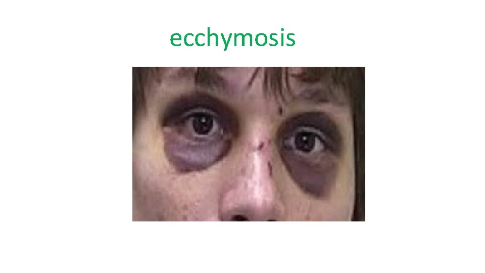 CONTENTS Objectives Definition Normal Anatomy of Blood Vessels