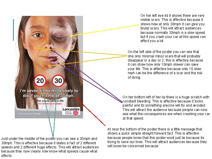 On her left eye lid it shows there