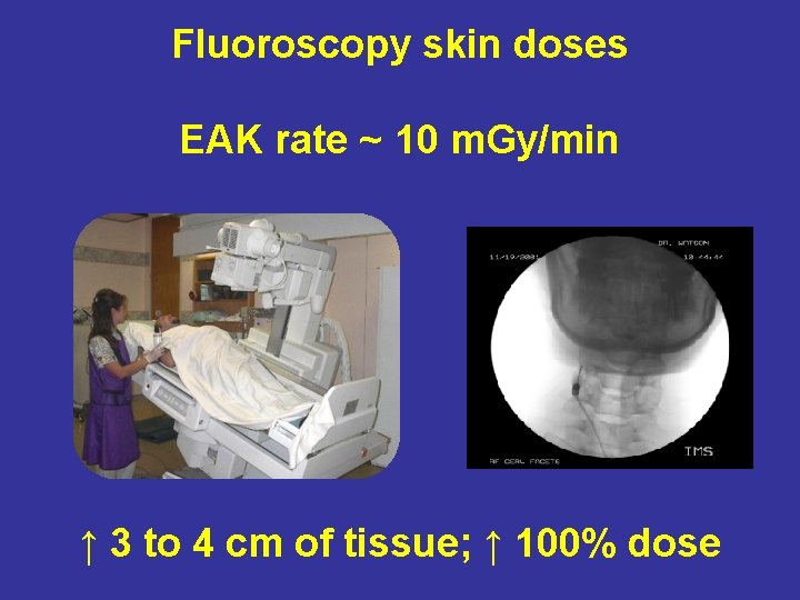 Interventional Radiology Doses Walter Huda Ph D Radiology