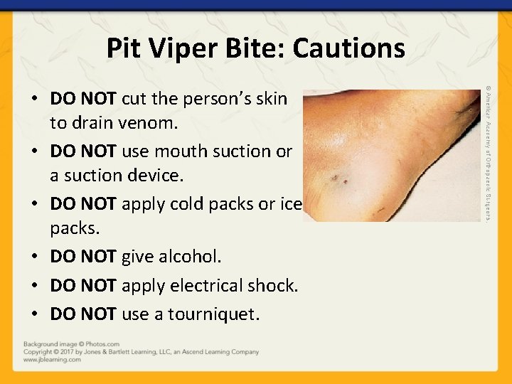 Chapter 5 Environmental Emergencies Animal Bites What to