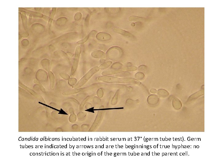CANDIDA CRYTOCOCCUS Lecture 15 Prepared by Miss Norzawani