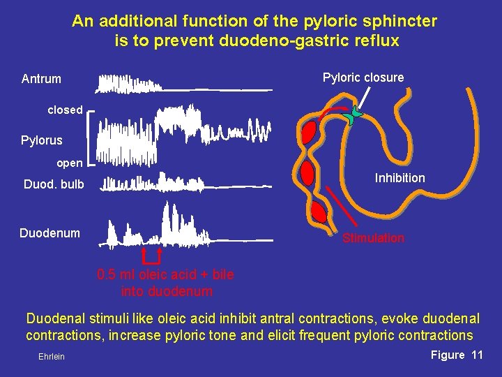 The stomach can be divided into three anatomic