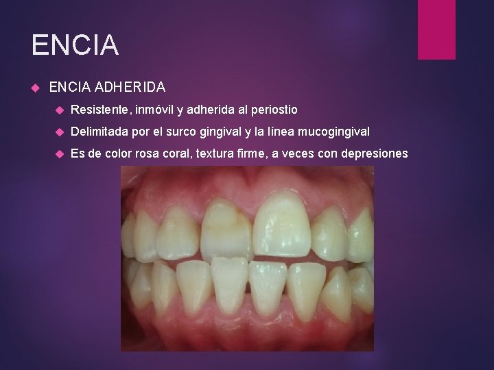 TEJIDOS DE PERIODONTO PERIODONCIA I DRA SILVIA A