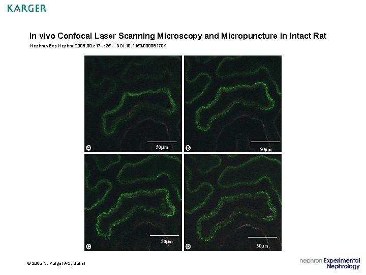 In vivo Confocal Laser Scanning Microscopy and Micropuncture