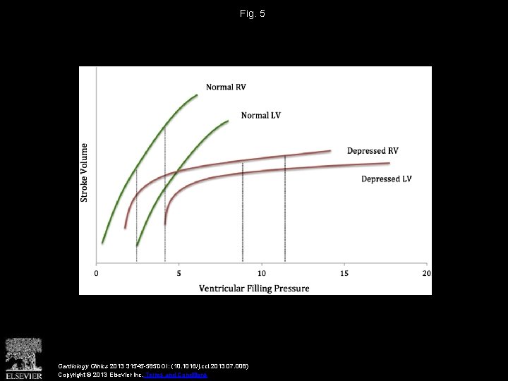 The Pulmonary Artery Catheter Umesh K Gidwani MD