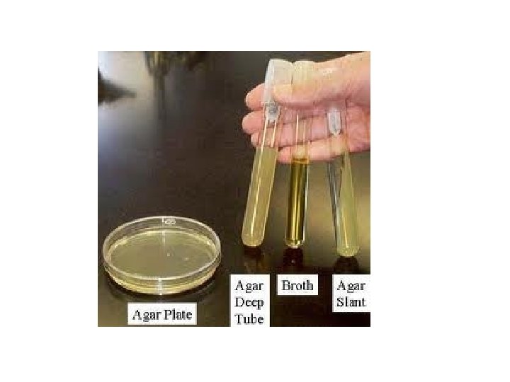 Media Figure 1 16 Bacterial colonies on agar