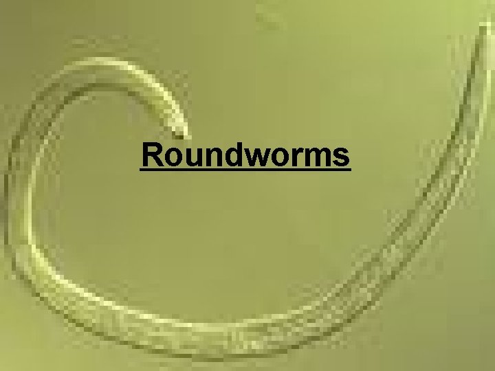 Unsegmented Worms Flatworms Flatworms Belong to the phylum