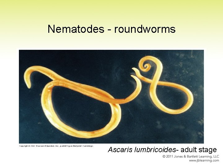 Parasites Beware of potentially graphic content 1 Helminths