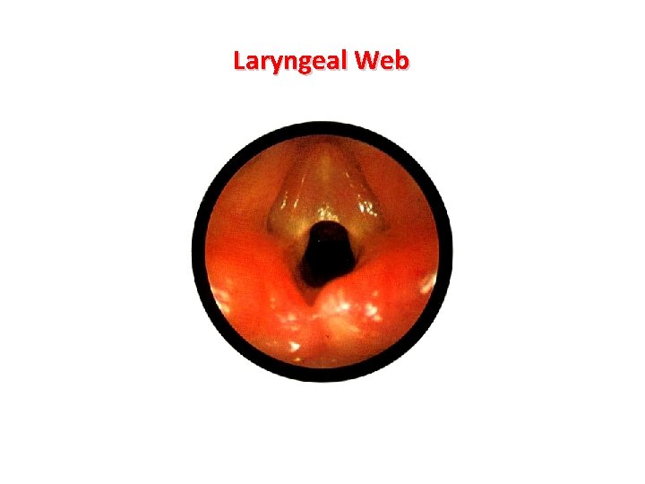 Masqueraders of Asthma Differential Diagnosis of Asthma in