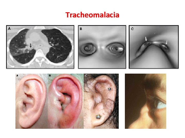 Masqueraders of Asthma Differential Diagnosis of Asthma in