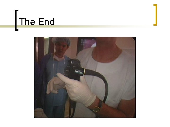 Laparoscopically Assisted Endoscopic PEG tube insertion Adrian Fox