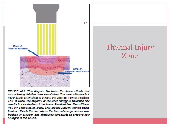 Fractional Laser 1 SANTI DEVINA PEMBIMBING DR LYNDA