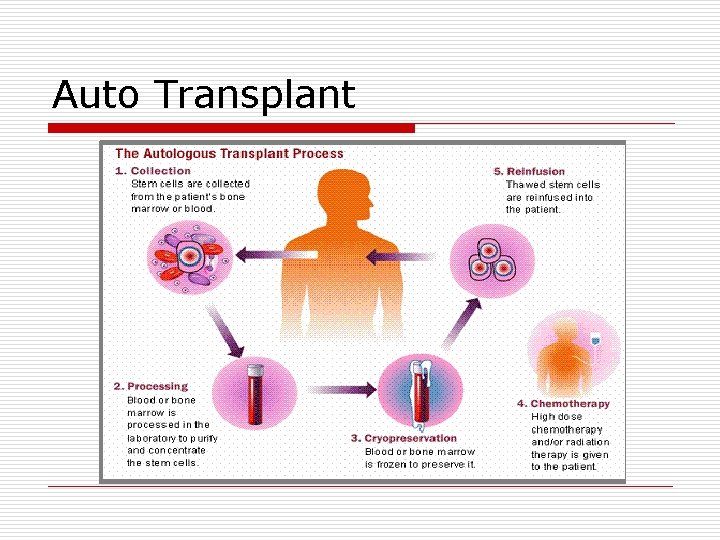 Bone Marrow Transplant in Oncology Source Pathology o