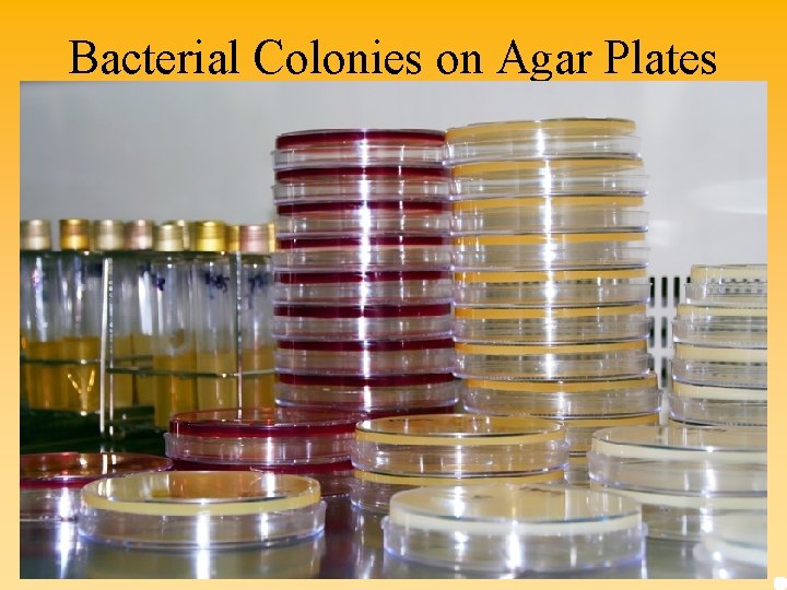 Quantification of morphology of bacterial colonies using laser