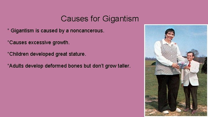 Gigantism By Natalie Valdovinos Andrea Siordia Science Period