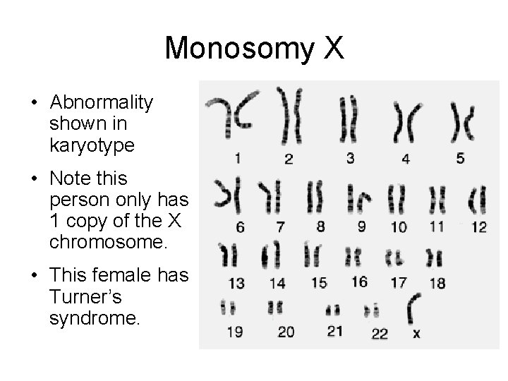 Unit 2 AOS 2 KK 2 Chromosomes Karyotypes