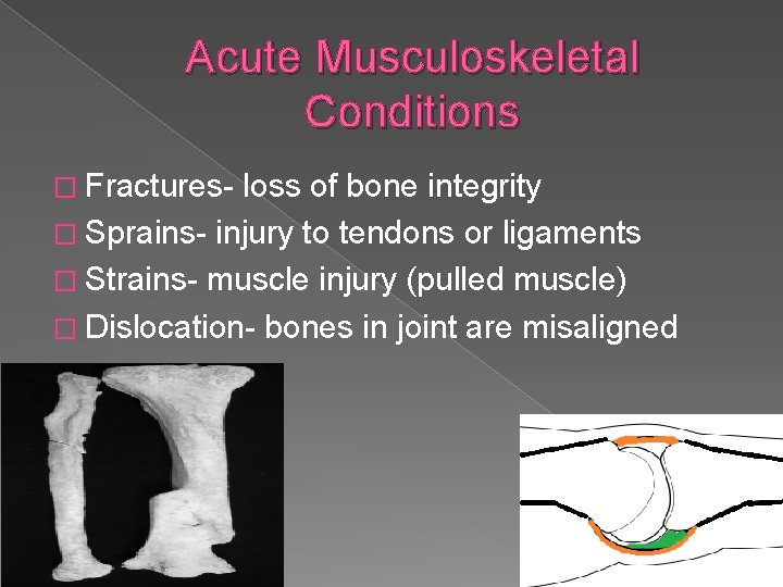 Module 1 Day 3 Acute Chronic Musculoskeletal Conditions