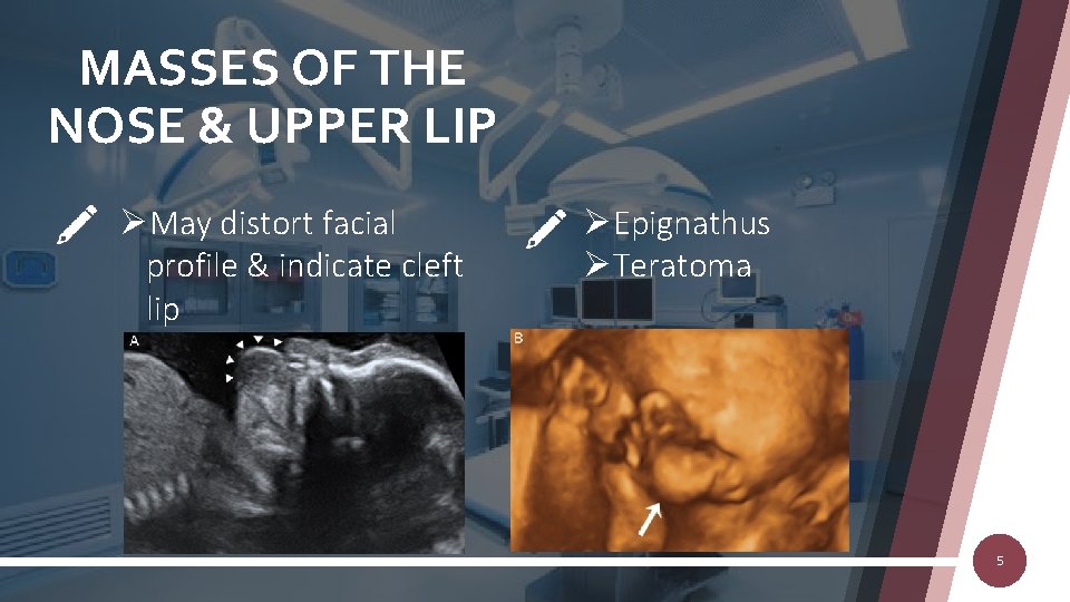 FETAL FACE NECK ANOMALIES BY AMANDA MEADOWS DMS