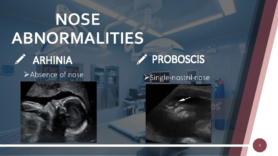 FETAL FACE NECK ANOMALIES BY AMANDA MEADOWS DMS