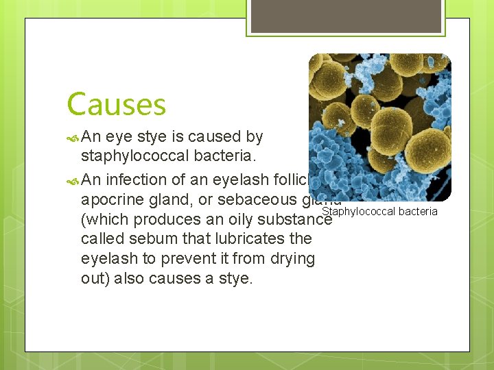 Eye Stye By Carissa Preboth and Hayley Meisch