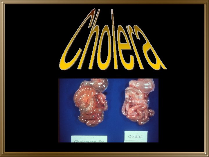 What is Cholera Cholera is an acute intestinal